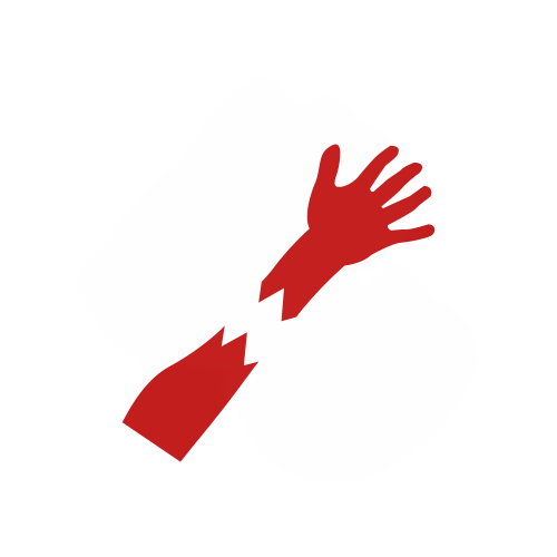 Simple fracture of radius | ProjectHospital Wiki | Fandom