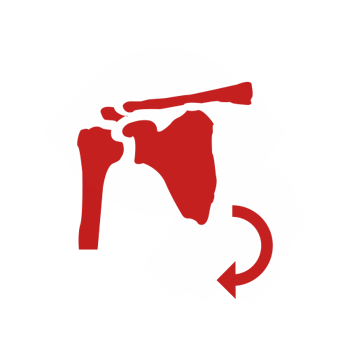 Shoulder dislocation | ProjectHospital Wiki | Fandom