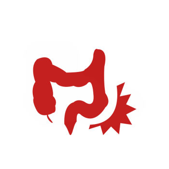 Ulcerative colitis | ProjectHospital Wiki | Fandom