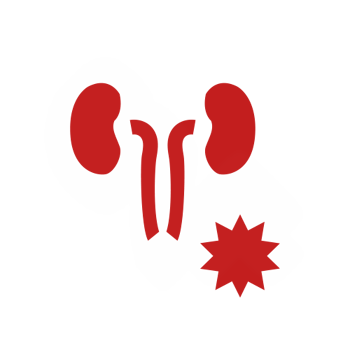 Pyelonephritis | ProjectHospital Wiki | Fandom