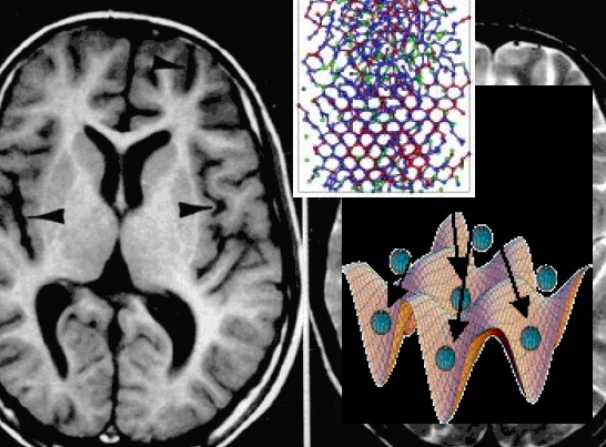 Quantum consciousness | Protoscience | Fandom