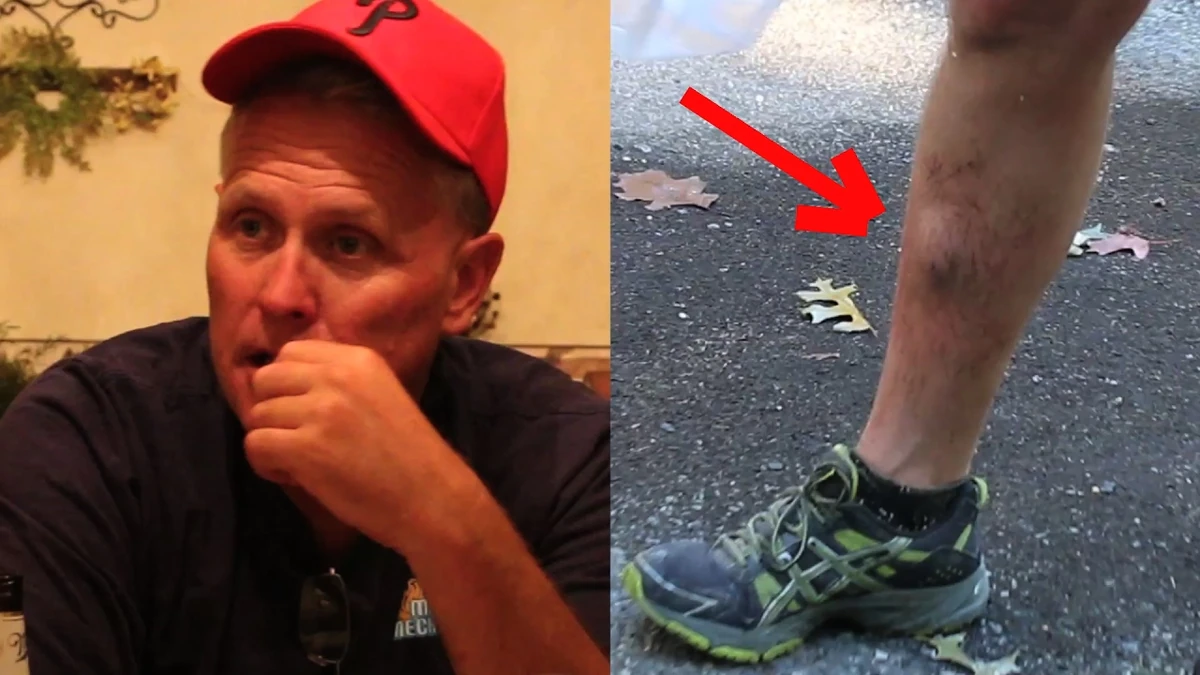 PSYCHO DAD BREAKS LEG! *ALMOST RE-CAST* | Psycho kid Wiki | Fandom