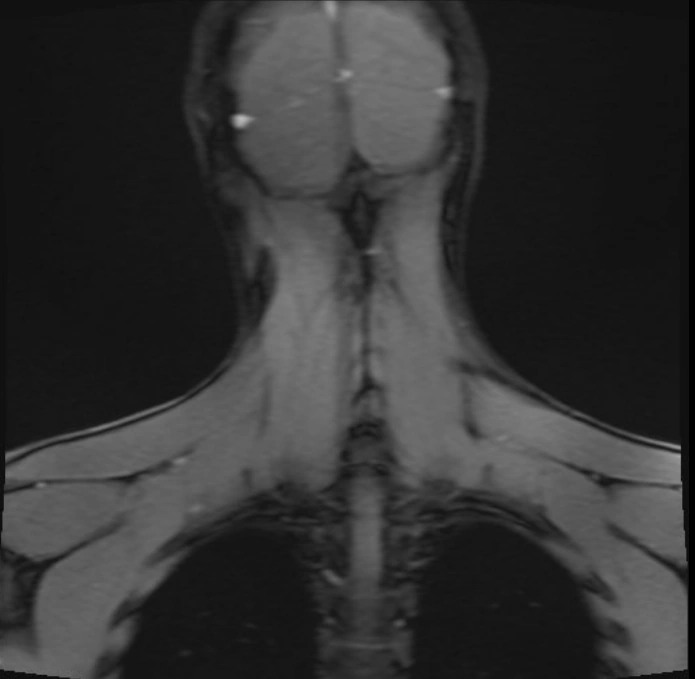 Senior Saga | Purge Wiki | Fandom