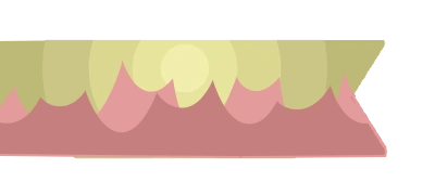 Ginger Zap (PvZ: BfN) | Plants vs. Zombies Character Creator Wiki | Fandom