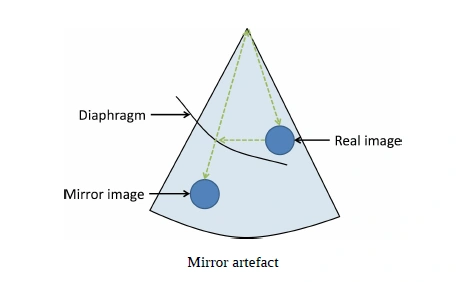 5:22: Refraction Artifact | RadAIT Wiki | Fandom