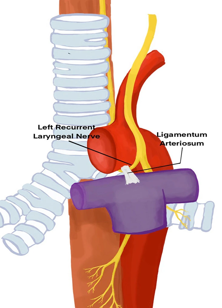Ductus Arteriosus Ligamentum Arteriosum Mediastinum Atlas Of Anatomy