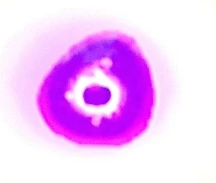 Purple Orb | Radiatapedia | Fandom