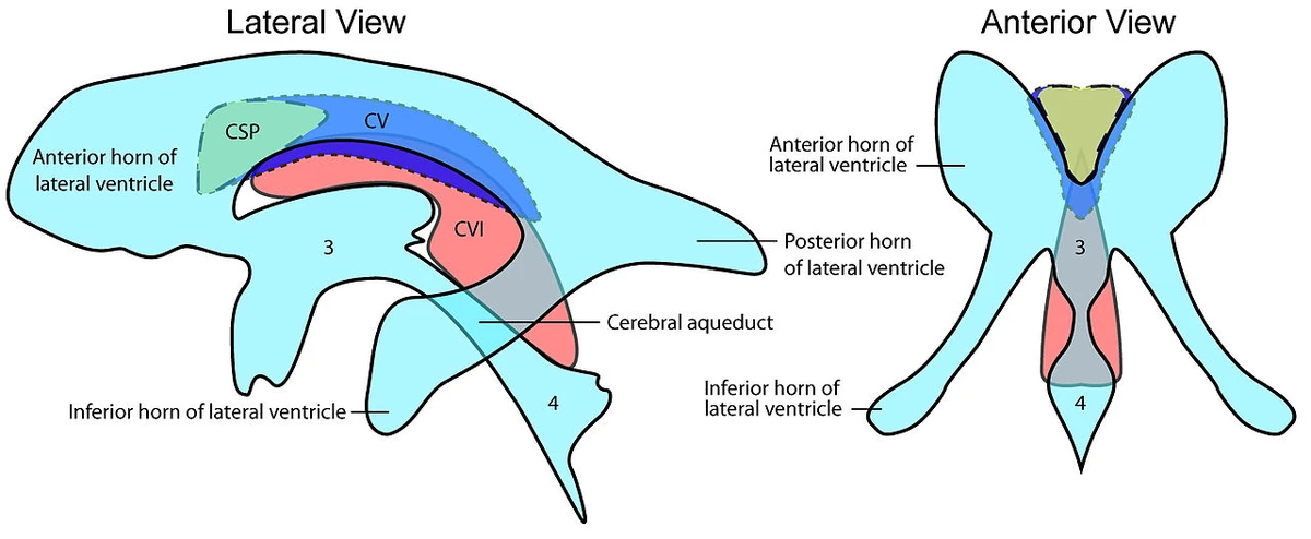 Septum pellucidum, velum interpositum | RANZCRPart1 Wiki | Fandom
