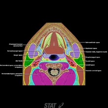 Superficial DCF:Parotid space | RANZCRPart1 Wiki | Fandom