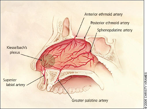 Nasopalatine Artery And Sphenopalatine Artery