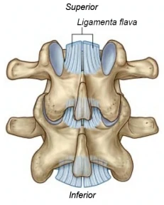 Spine & Back:Ligaments:Ligamentum flavum | RANZCRPart1 Wiki | Fandom