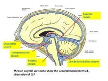 Basal CSF cisterns:Interpeduncular cistern | RANZCRPart1 Wiki | Fandom