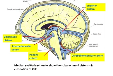 Cerebellopontine Cistern Anatomy