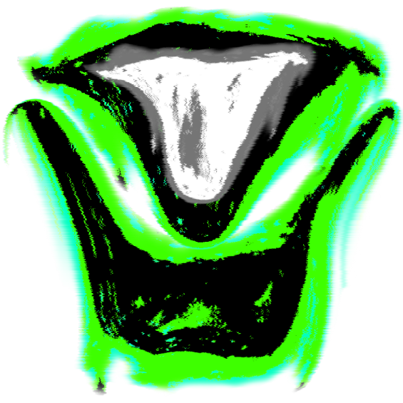 Discuss Everything About Redetermined Rooms Wiki | Fandom