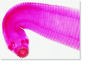 Tenia | Wiki Reino Animalia | Fandom