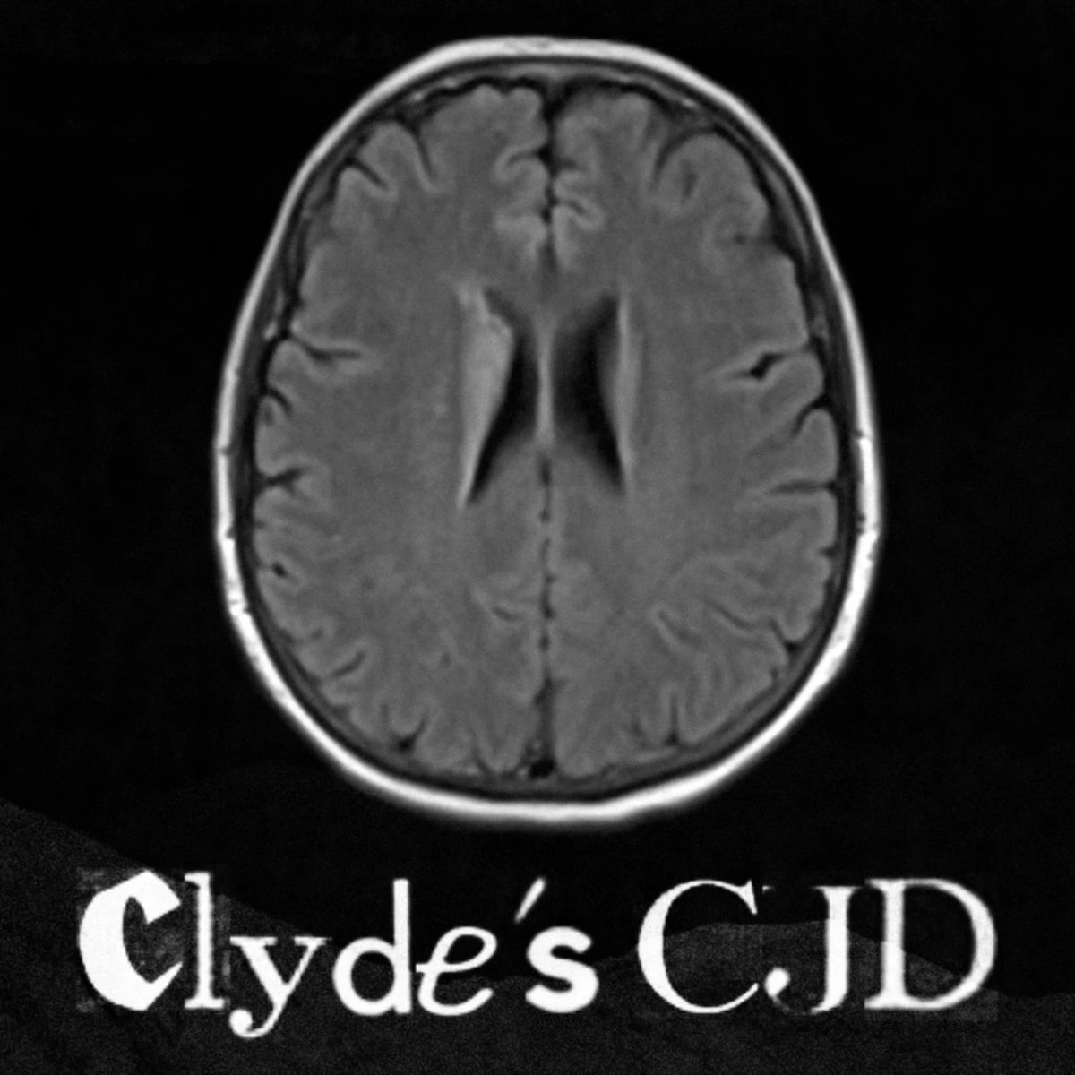 Clyde's CJD : Part 1 | Retrograde CT Works Wiki | Fandom