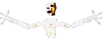 The Strife | Interliminality Wiki | Fandom