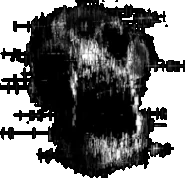 A-90 (Paralysis) | Roblox Rooms & Doors Wiki | Fandom