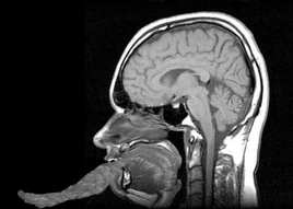 SCP-4038 | SCP Database Wiki | Fandom