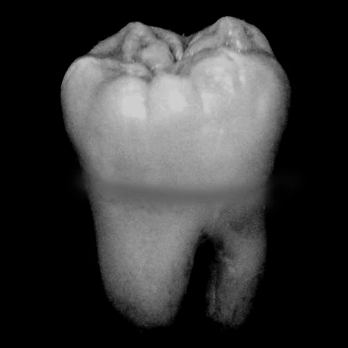 SCP-1885 | SCP Database Wiki | Fandom