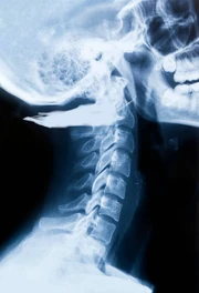 SCP-264 | SCP Fanon Wiki | Fandom