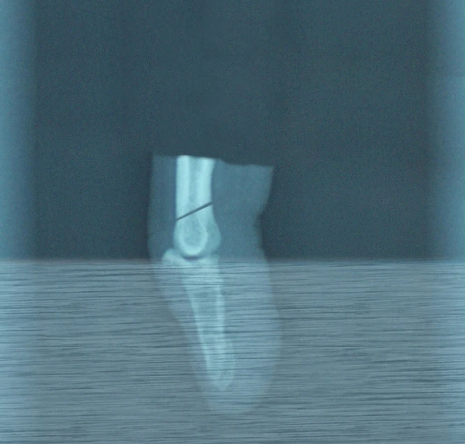 SCP-170 | Wiki La Fundación SCP | Fandom