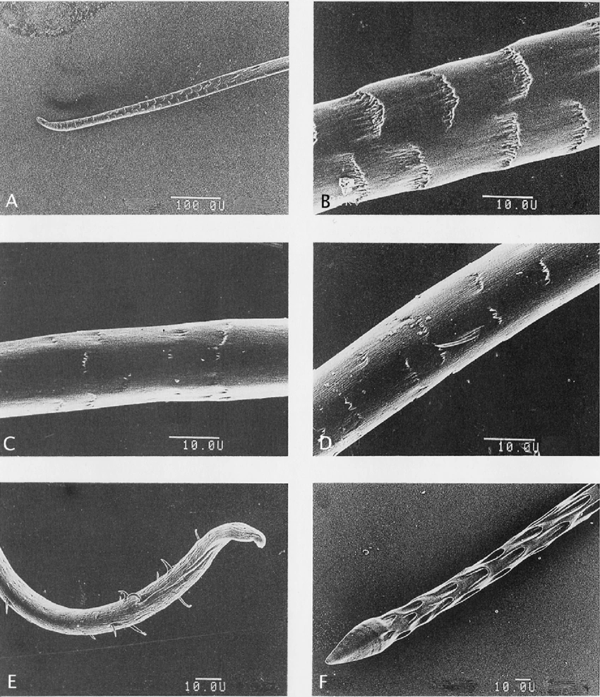 Diplotrema planumfluvialis | Segmented Worms Wiki | Fandom