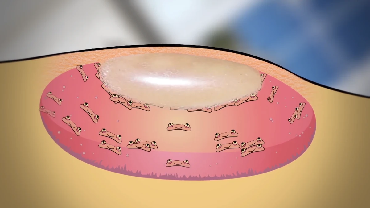 operation ouch holly