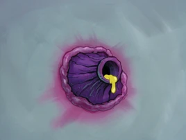 Barnacles (disease) | Encyclopedia SpongeBobia | Fandom