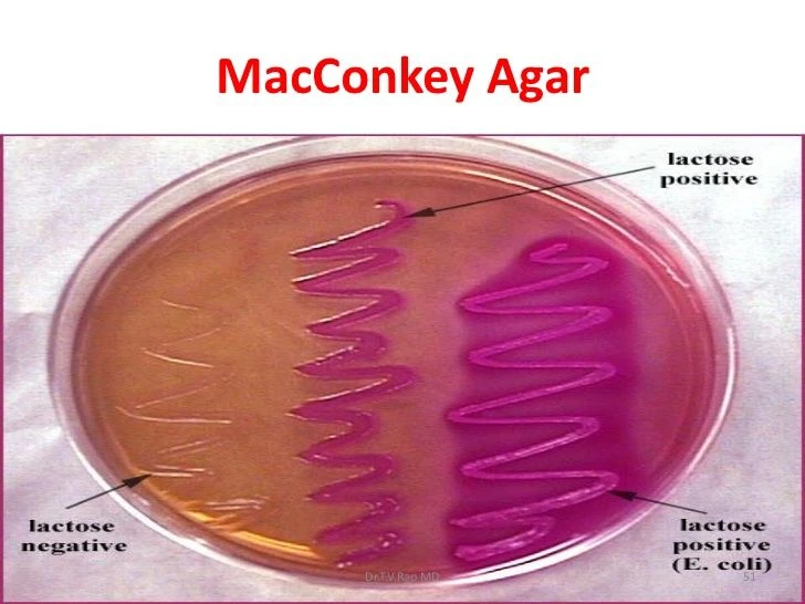 Enterococcus Faecalis Macconkey Agar