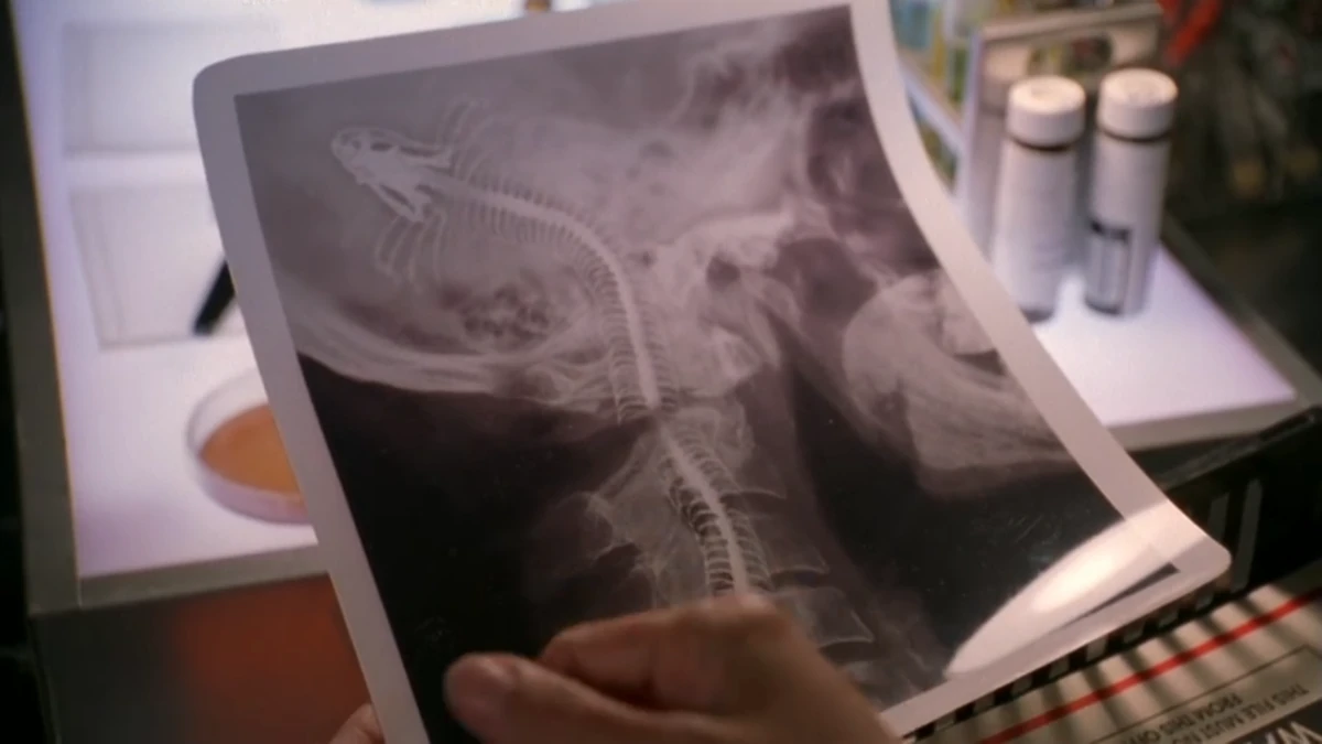 Cervical vertebrae | SGCommand | Fandom