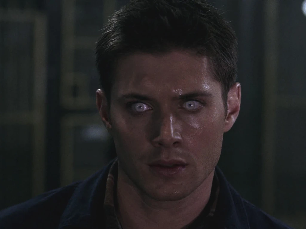 Skin | Supernatural Wiki | Fandom