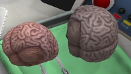 Brain | Surgeon Simulator Wiki | Fandom