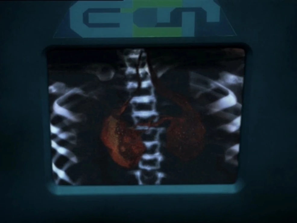 binary vascular system