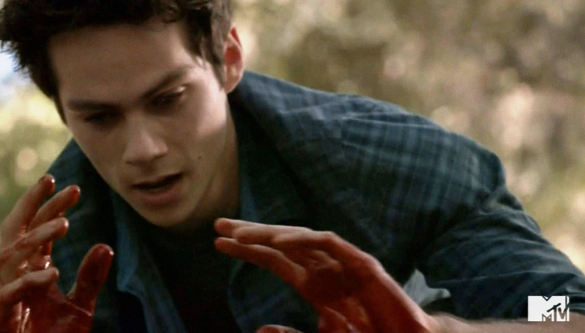 Poison | Wiki Teen Wolf | Fandom