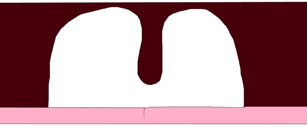 List of Uvula Shots | The Dangers of Love Wiki | Fandom