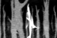 Horned Serpent Metastructure | The Monument Mythos Wiki | Fandom