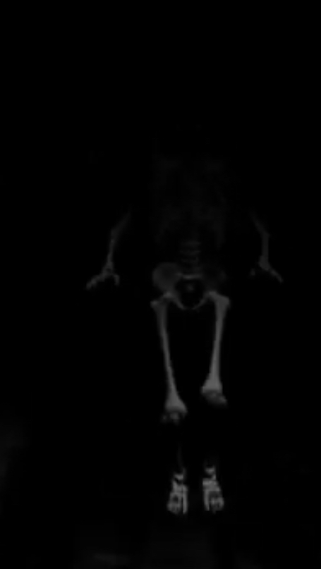 Phase 93 Uncanny Cool Yakko Warner | The Mr Incredible Becoming Memes ...