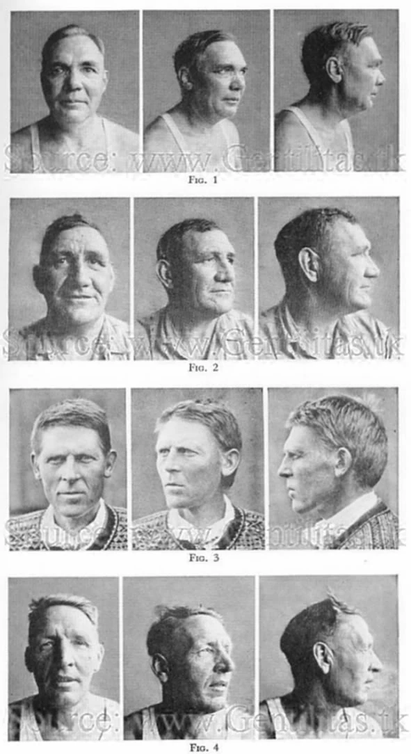 German And Scandinavian Facial Features