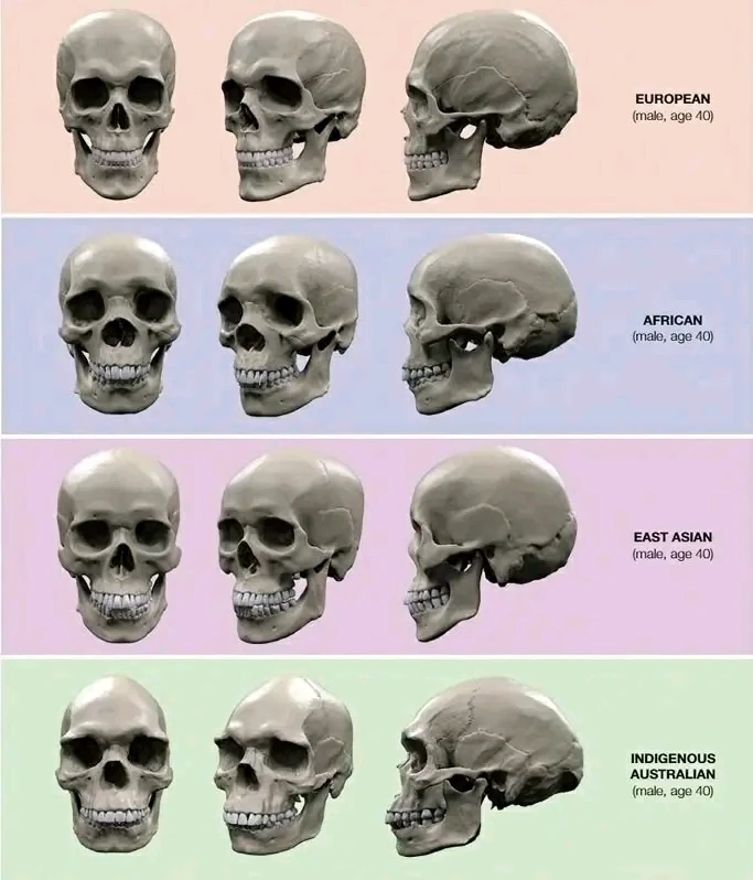 Low Cheekbones Skull