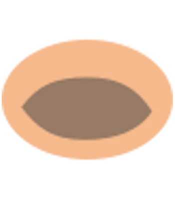 Jawed Mouth | The Sapling-Pedia | Fandom