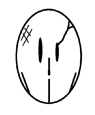 The Skulliosis Wiki | Fandom