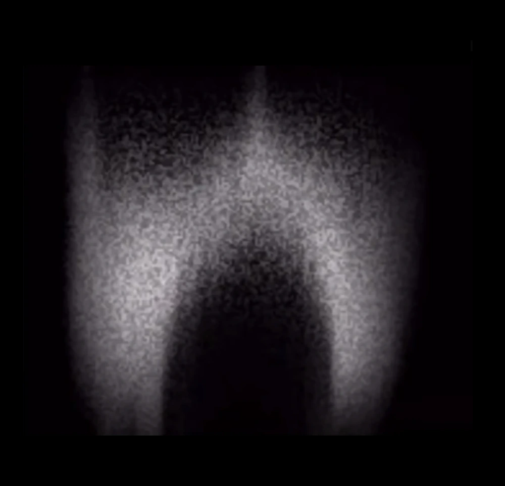 Phase 228 (Gold XD) | The Uncanny Incredible: Deluxe Wiki | Fandom