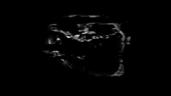 Phase 19 (MP108) | The Uncanny Incredible Wiki | Fandom