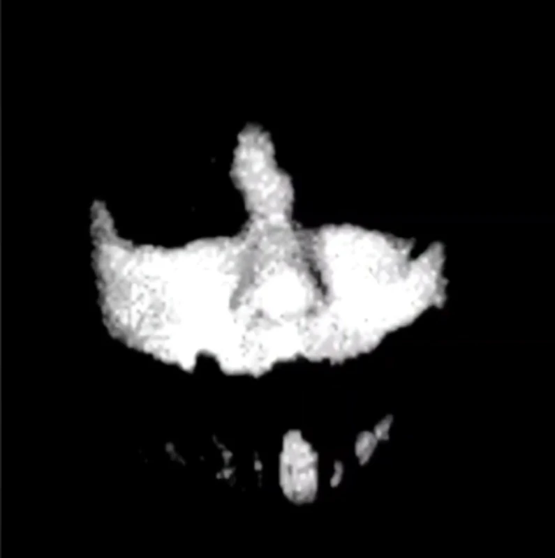 Phase 340 (Upgraded Yiğit Phase 34) | The Uncanny Incredible Wiki | Fandom