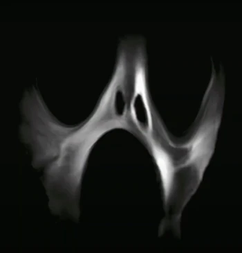 Phase 104 (Super Traumathon) | The Uncanny Incredible Wiki | Fandom