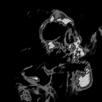 Phase 230 (MIBU 250 Phases) | The Uncanny Incredible Wiki | Fandom