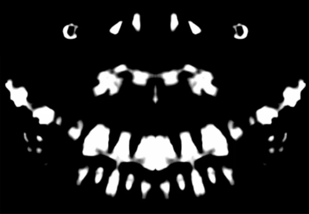 Phase 512 (Stist) | The Uncanny Incredible Wiki | Fandom