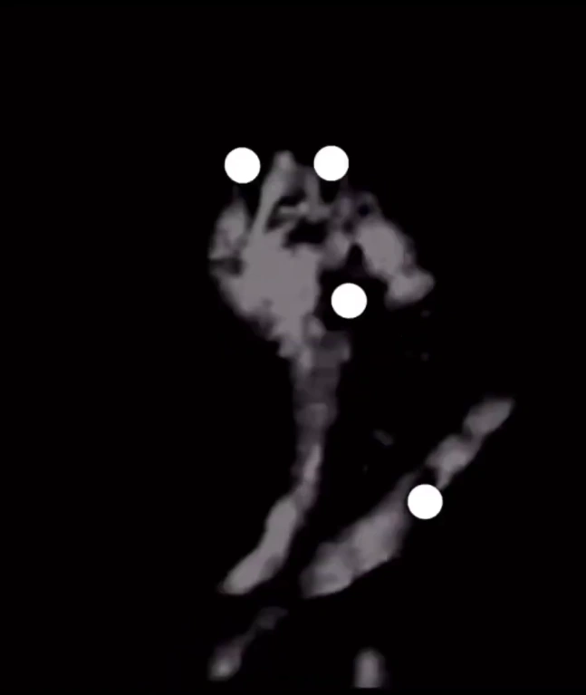 Phase 38 (Shadow Jaichner) | The Uncanny Incredible Wiki | Fandom