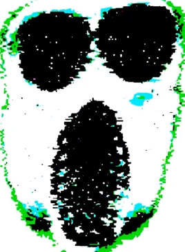 Phase 80 (Traumathon) | The Uncanny Incredible Wiki | Fandom